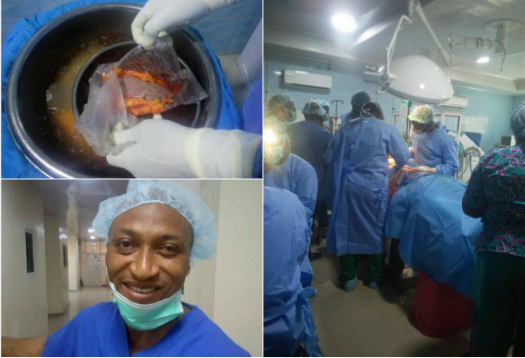 First Ever Successful Kidney Transplant In South East Took Place ...