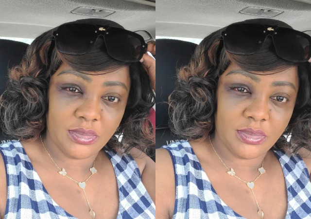 I Was Recently Involved In A Car Accident, I Suffered A Head Concussion ...