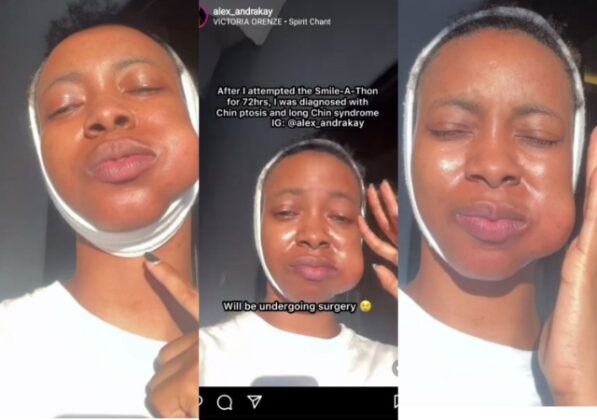 Young Nigerian Lady Diagnosed with Long Chin Syndrome After Completing ...