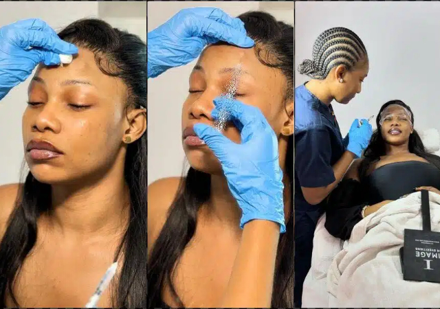 Tacha updates fans on her beauty journey as she get a Botox and fillers ...