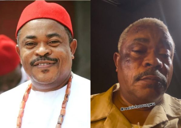 Fans express concern as Victor Osuagwu shares video showing his bruised ...