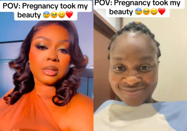 Lady lament as she shares facial transformation after getting pregnant ...