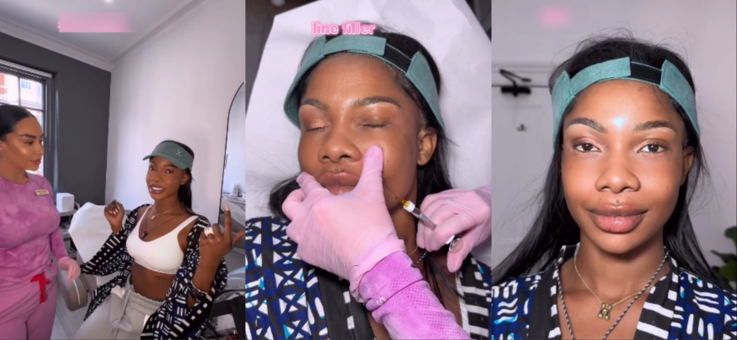 BBNaija’s Tacha Sparks Reactions After Undergoing Lip Fillers and Botox ...