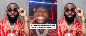 “My Teeth Is $500K And My Chain Is $2M”- Davido Boasts - Gistlover