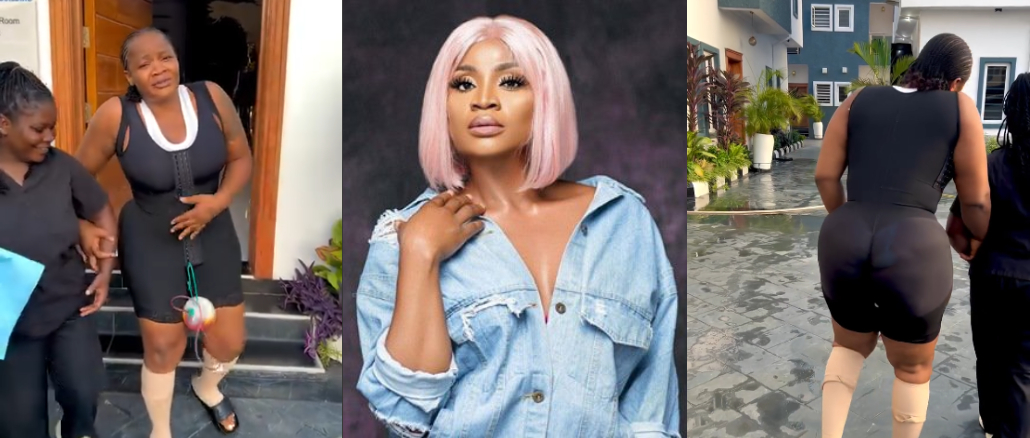 Actress Uche Ogbodo Undergoes BBL And Tummy Tuck Surgery - Gistlover