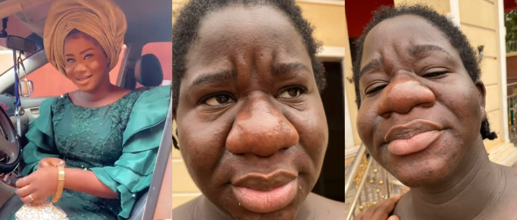 Woman Shares Astonishing Pregnancy Transformation - Gistlover