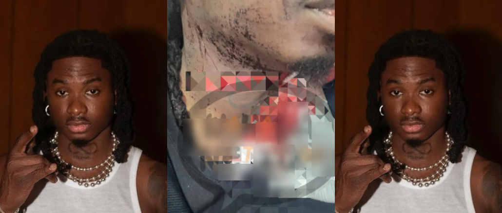 Rapper Lil Kesh Allegedly Stabbed During Robbery Attack In Lagos ...